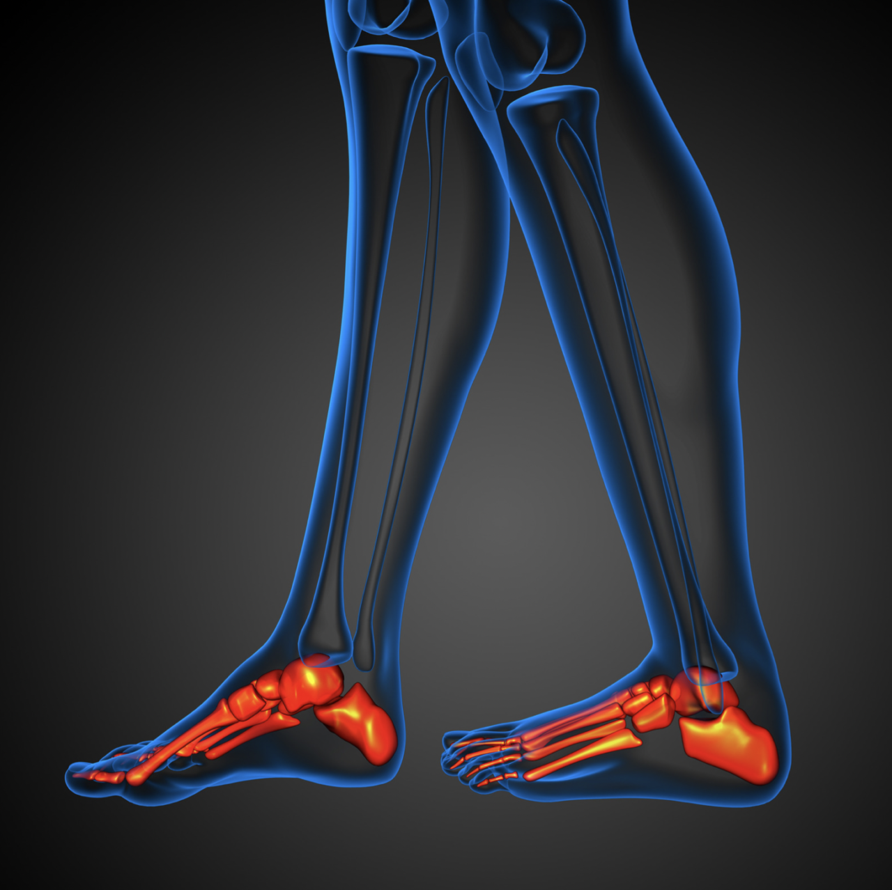 La maladie de Renander | label-orthopedie